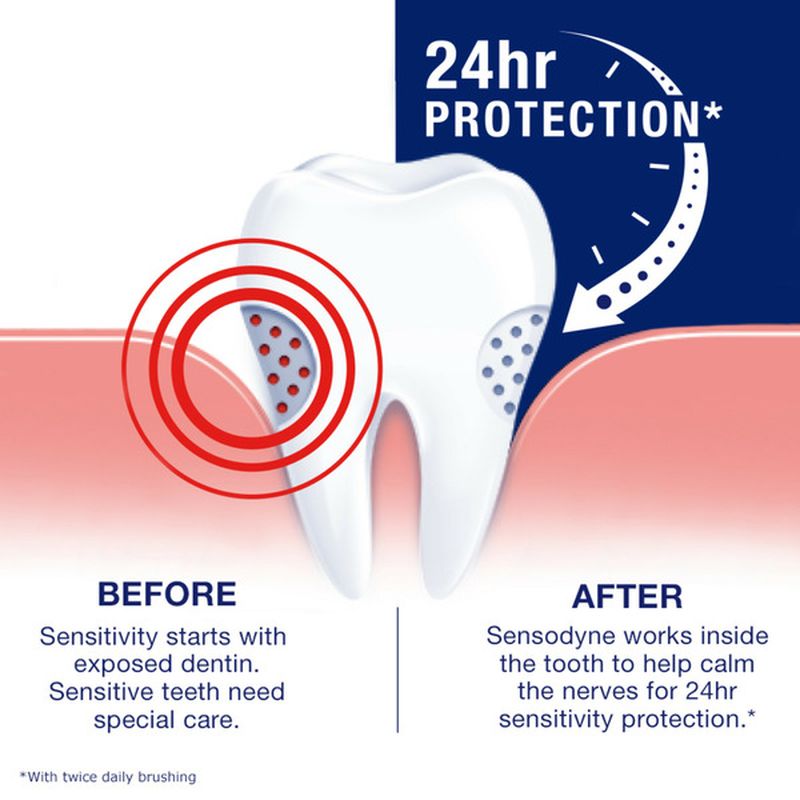 Sensodyne Sensitive Teeth Toothpaste Fresh Impact, Sensitive Teeth ...